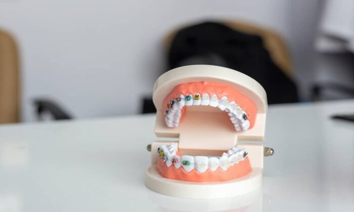 6 Causes of Crooked Teeth | How to Fix Misalignment [Treatment]